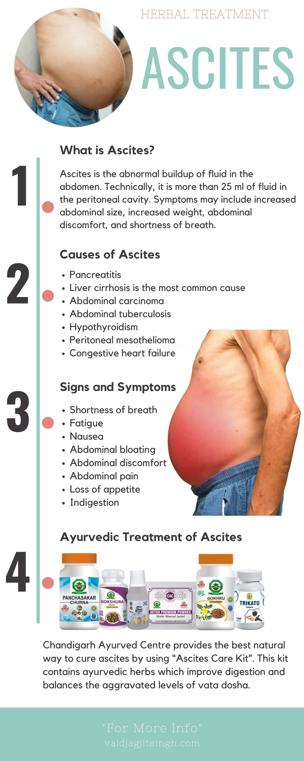 PPT - Ascites - Causes, Symptoms and Herbal Treatment PowerPoint ...