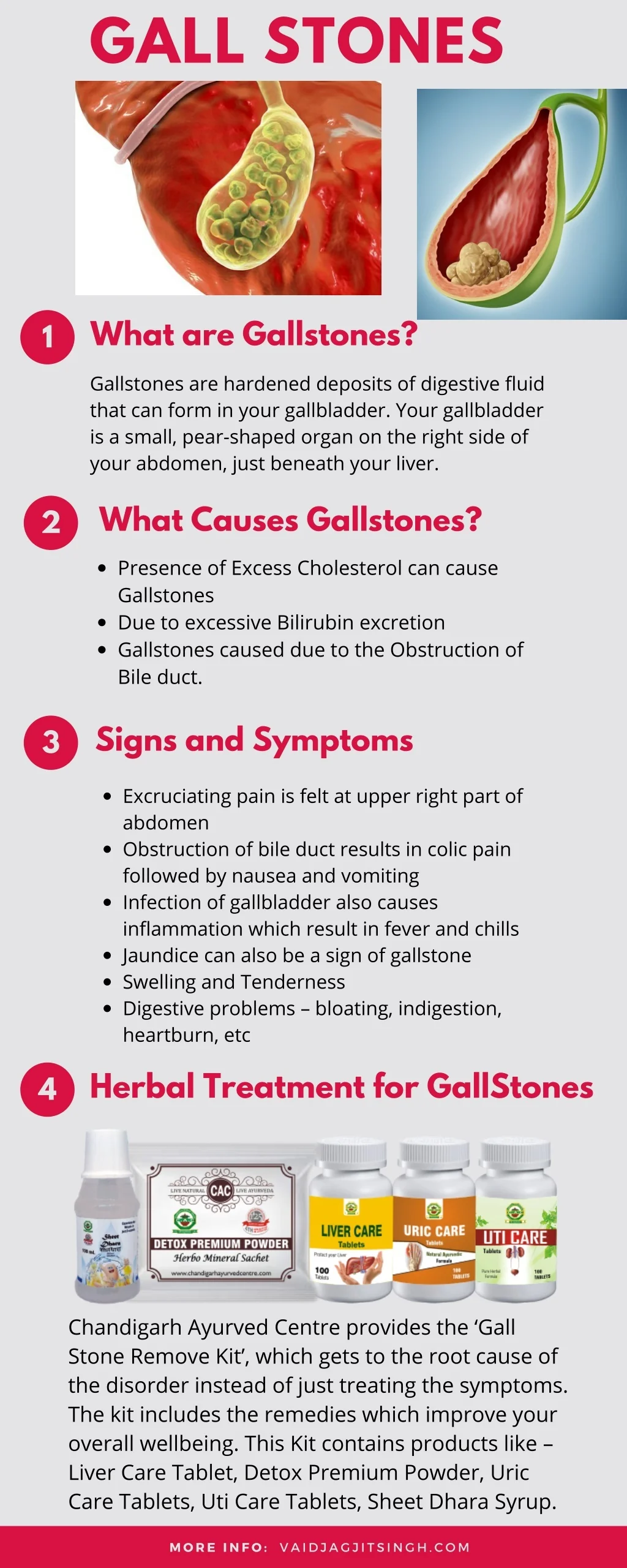 PPT - Gall stones - Causes, Symptoms and Herbal Treatment PowerPoint ...