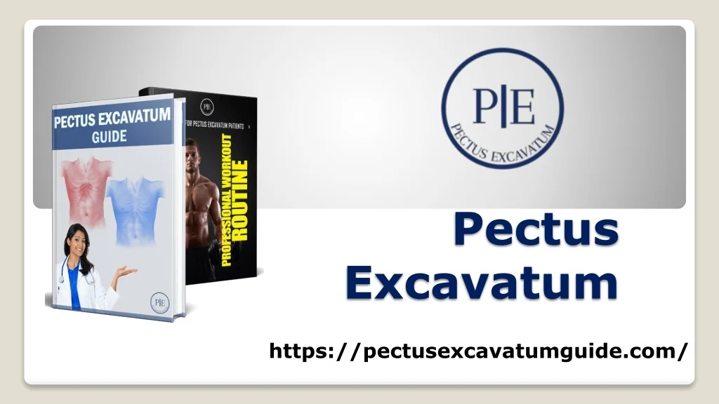 PPT - Treatments For Pectus Excavatum - Pectus Excavatum Guide ...