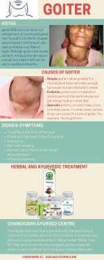 PPT - Goiter PowerPoint Presentation, free download - ID:2913506