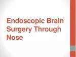 PPT - Principles of Functional Endoscopic Sinus Surgery PowerPoint ...