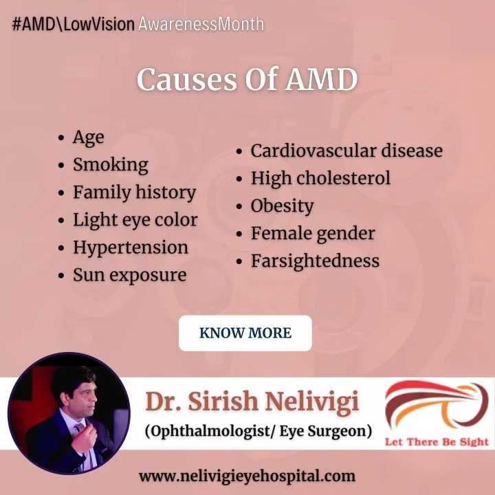 PPT - Causes of AMD | Best Eye Hospitals in Bellandur, Bangalore ...