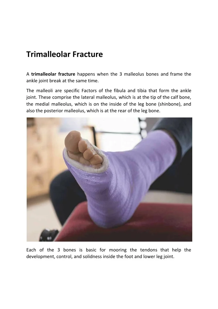 PPT - Trimalleolar Fracture Symptoms, Causes and Treatment PowerPoint ...