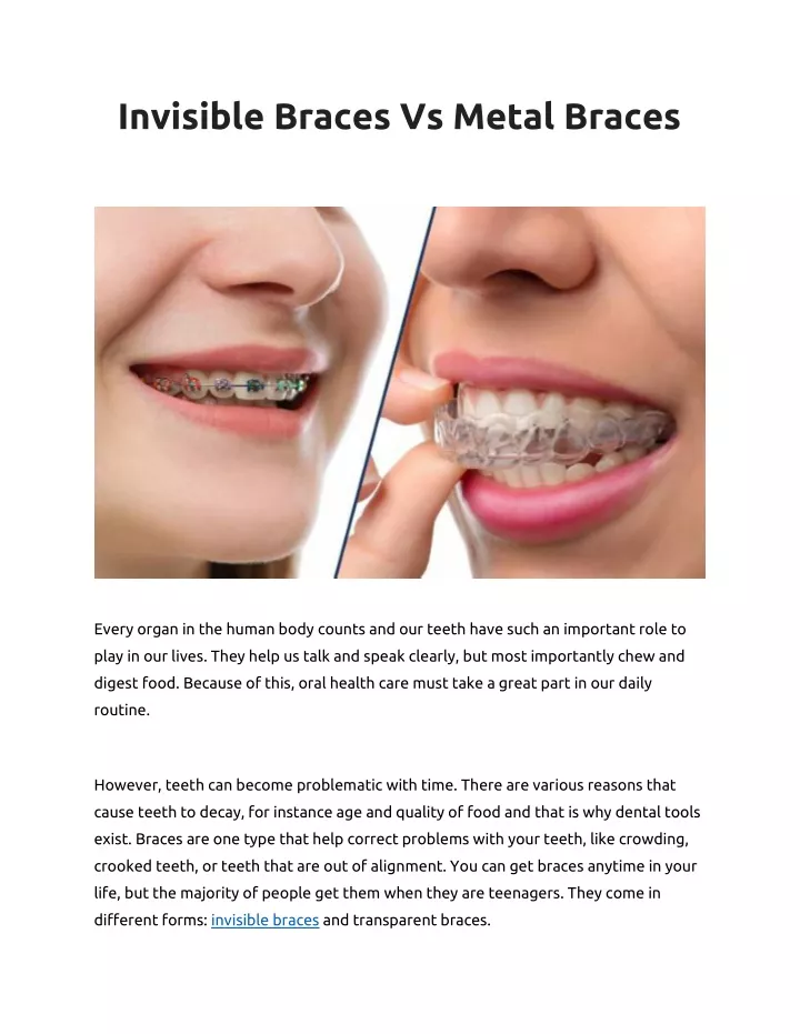 Ppt Invisible Braces Vs Metal Braces Powerpoint Presentation Free