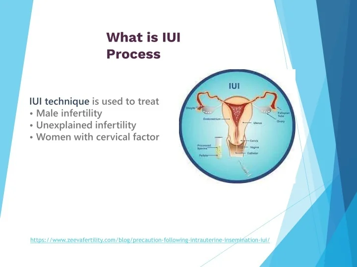 PPT - IUI treatment in noida PowerPoint Presentation, free download ...