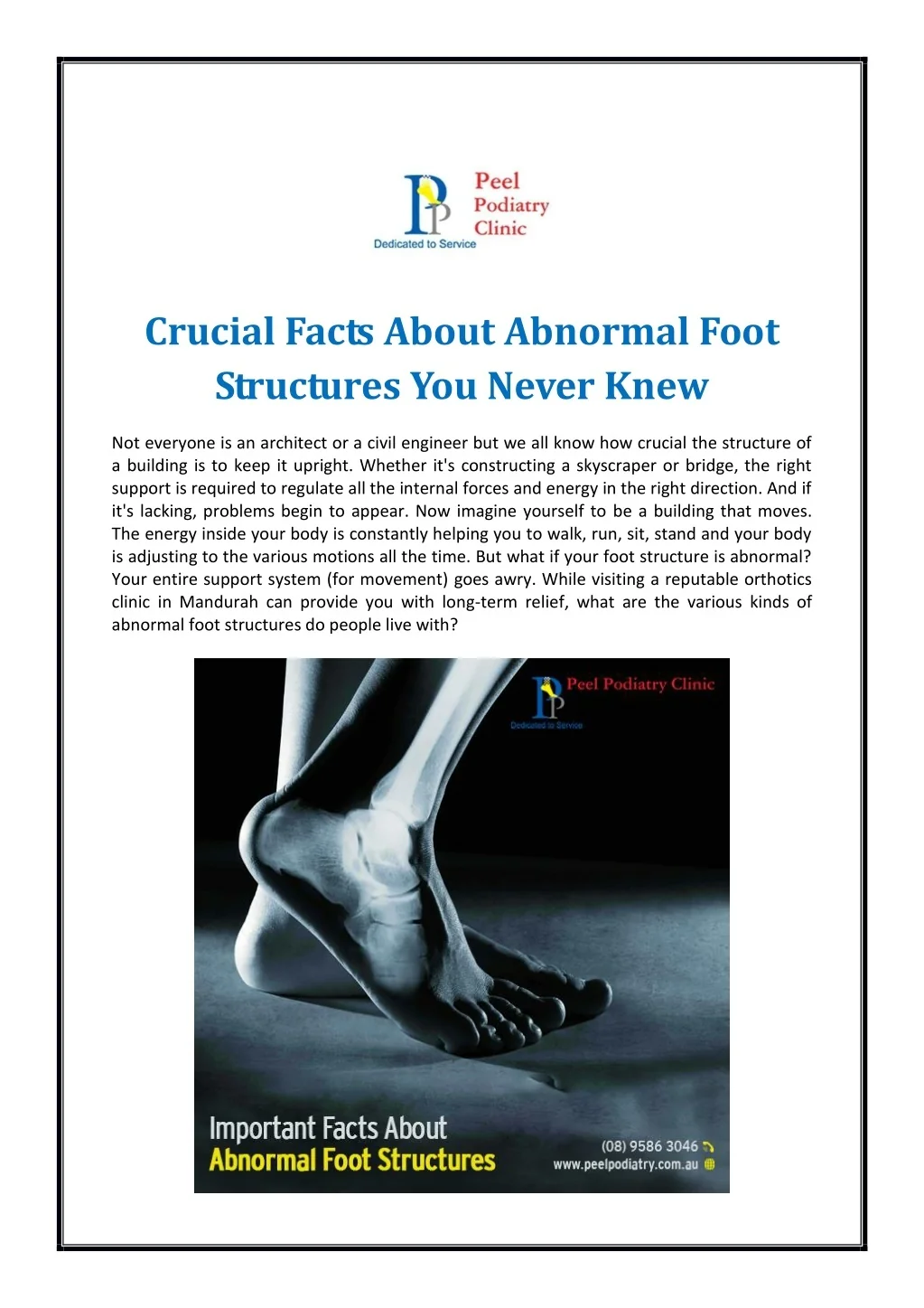PPT - Crucial Facts About Abnormal Foot Structures You Never Knew ...