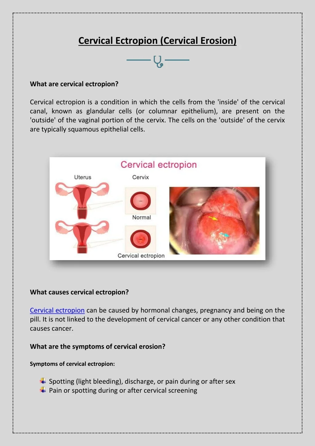 PPT - What are Cervical Ectropion? PowerPoint Presentation, free ...