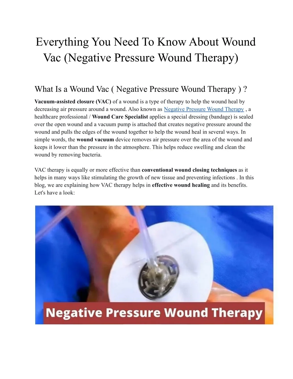PPT - Everything You Need To Know About Wound Vac (Negative Pressure ...