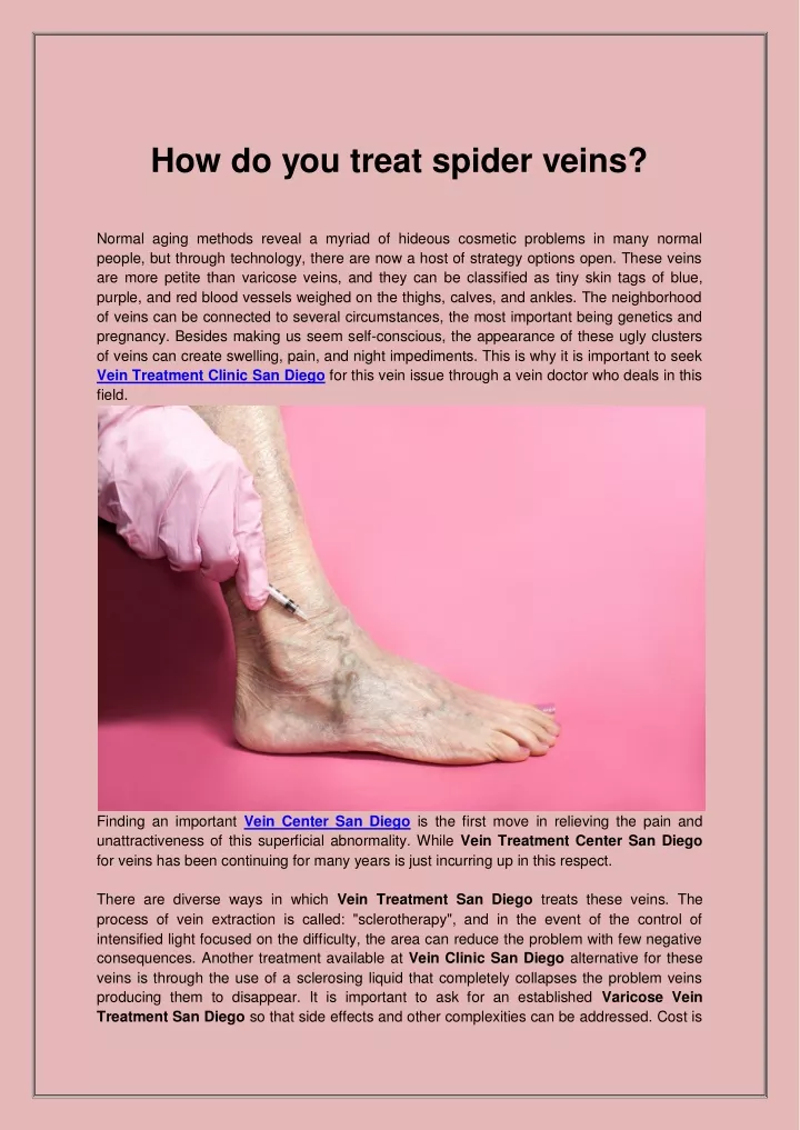 Ppt How Do You Treat Spider Veins Powerpoint Presentation Free Download Id10853056