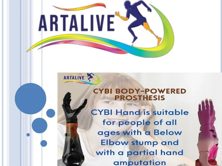 PPT - motorica-prosthetics-upper-limb-cybi-hand - Artalive PowerPoint ...