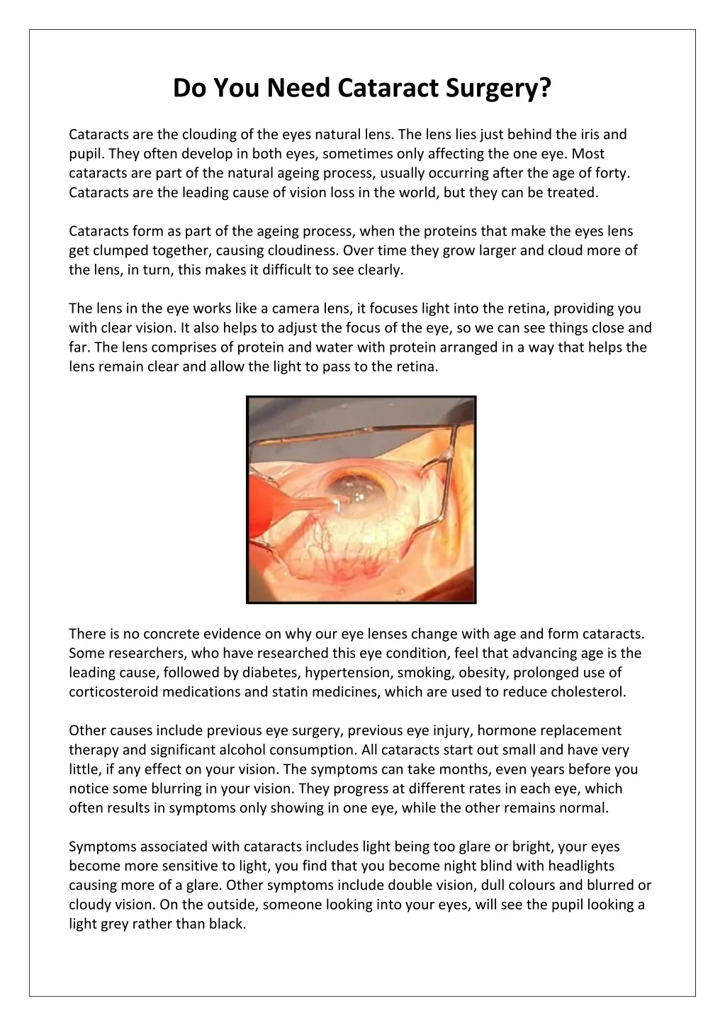 PPT - Do You Need Cataract Surgery PowerPoint Presentation, free ...