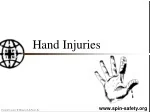 PPT - Hand injuries PowerPoint Presentation, free download - ID:3530668