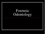 PPT - FORENSIC ODONTOLOGY PowerPoint Presentation, free download - ID ...