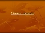 PPT - GASTRITIS PowerPoint Presentation, free download - ID:9634482