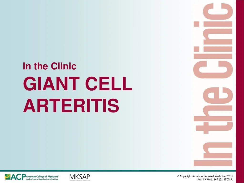 PPT - Giant Cell Arteritis: Risk Factors, Clinical Features, Diagnosis ...