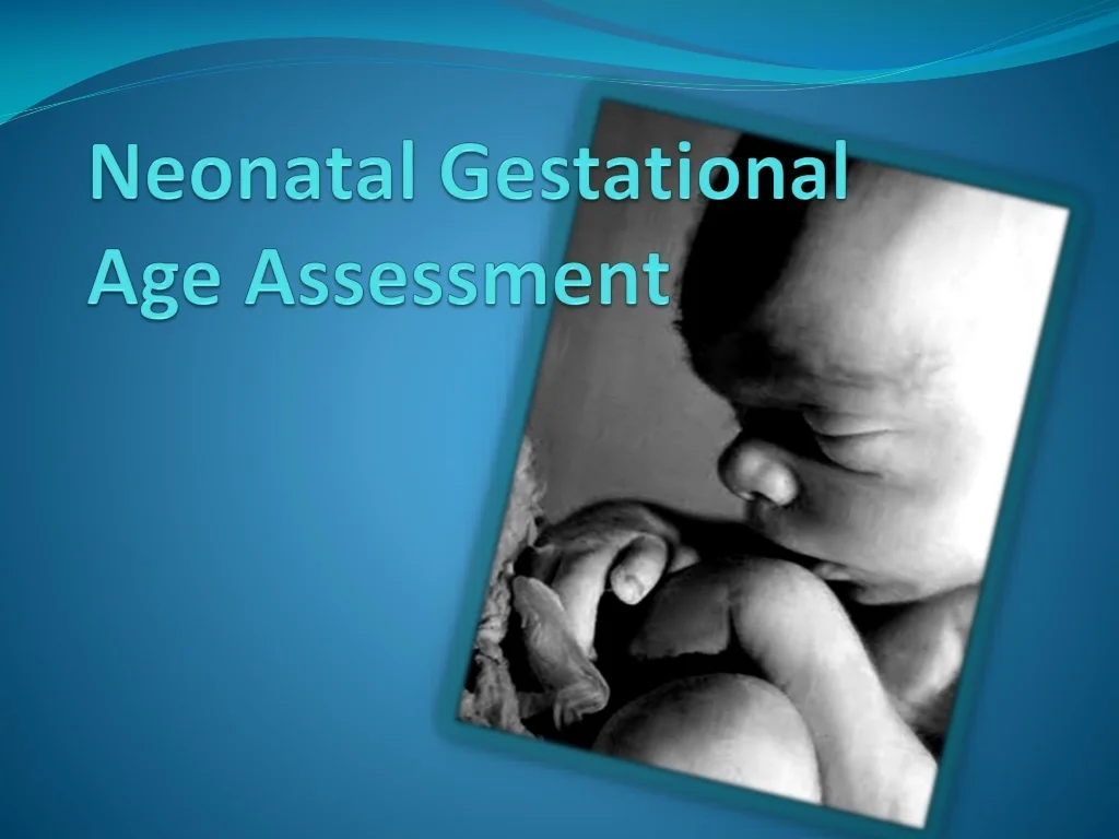 PPT - Neonatal Gestational Age Assessment: Tools and Examination ...