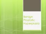PPT - Benign prostatic Hyperplasia PowerPoint Presentation, free ...