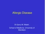 PPT - Allergic eye disease PowerPoint Presentation, free download - ID ...