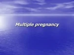 PPT - MULTIPLE PREGNANCY PowerPoint Presentation, free download - ID ...