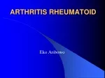 PPT - Rheumatoid Arthritis PowerPoint Presentation, free download - ID ...