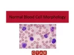 PPT - Abnormal Blood Cell Morphology PowerPoint Presentation, free ...