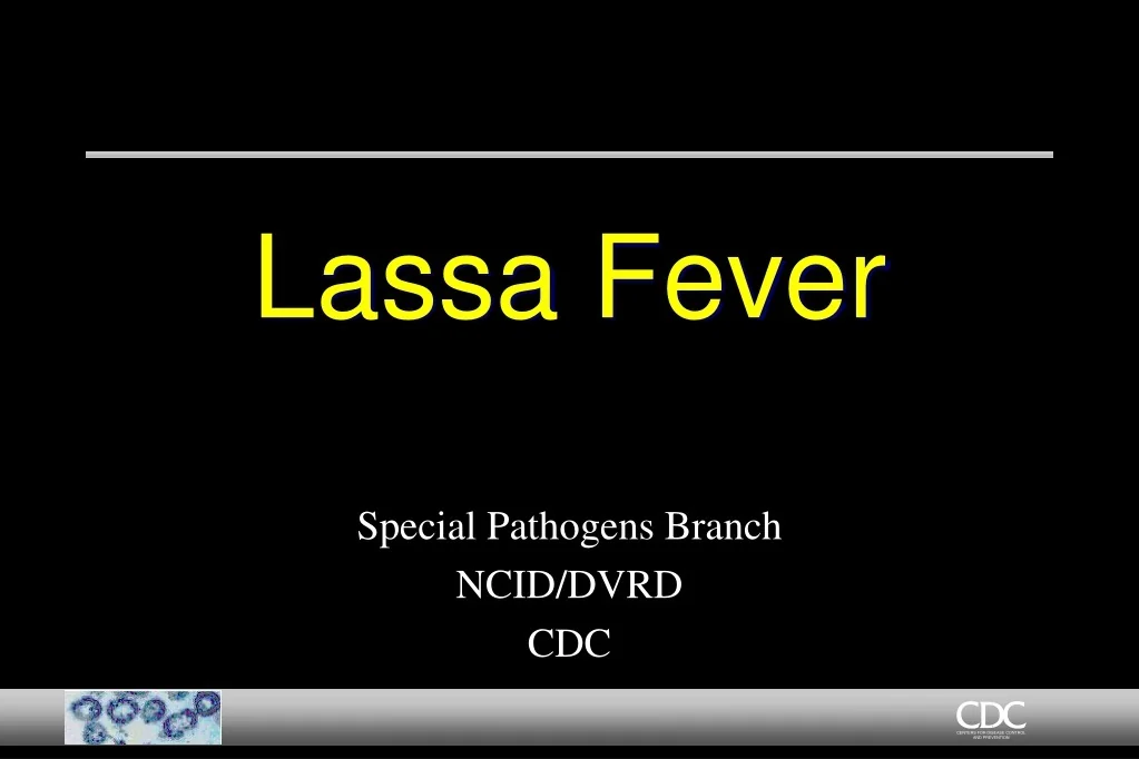 PPT - Lassa Fever PowerPoint Presentation, free download - ID:9397251