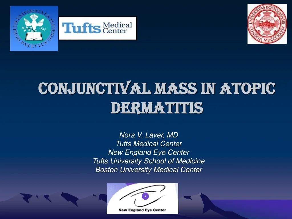 PPT - Conjunctival mass in atopic dermatitis PowerPoint Presentation ...