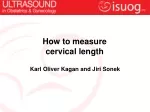 PPT - Cervical Length Screening in Obstetrics PowerPoint Presentation ...