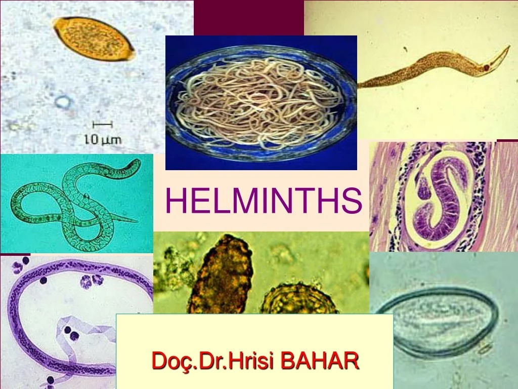 PPT - HELMINTHS PowerPoint Presentation, free download - ID:9411656