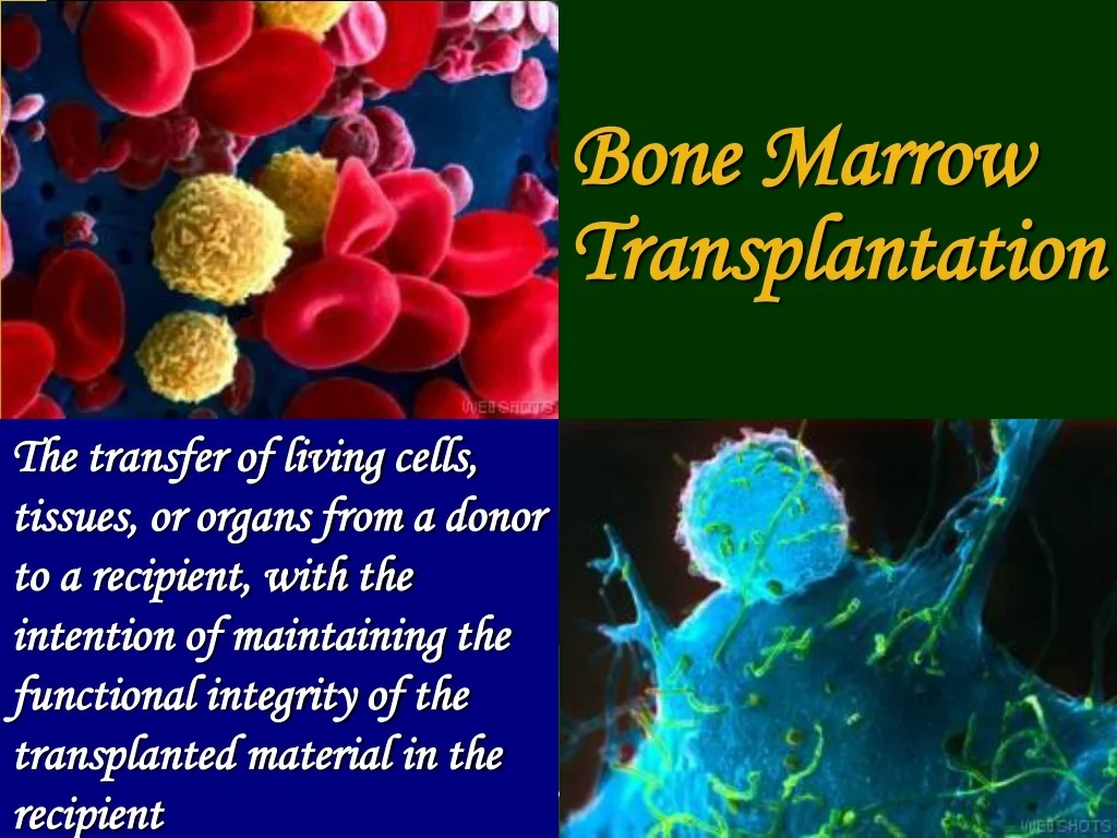 PPT - Bone Marrow Transplantation PowerPoint Presentation, free ...