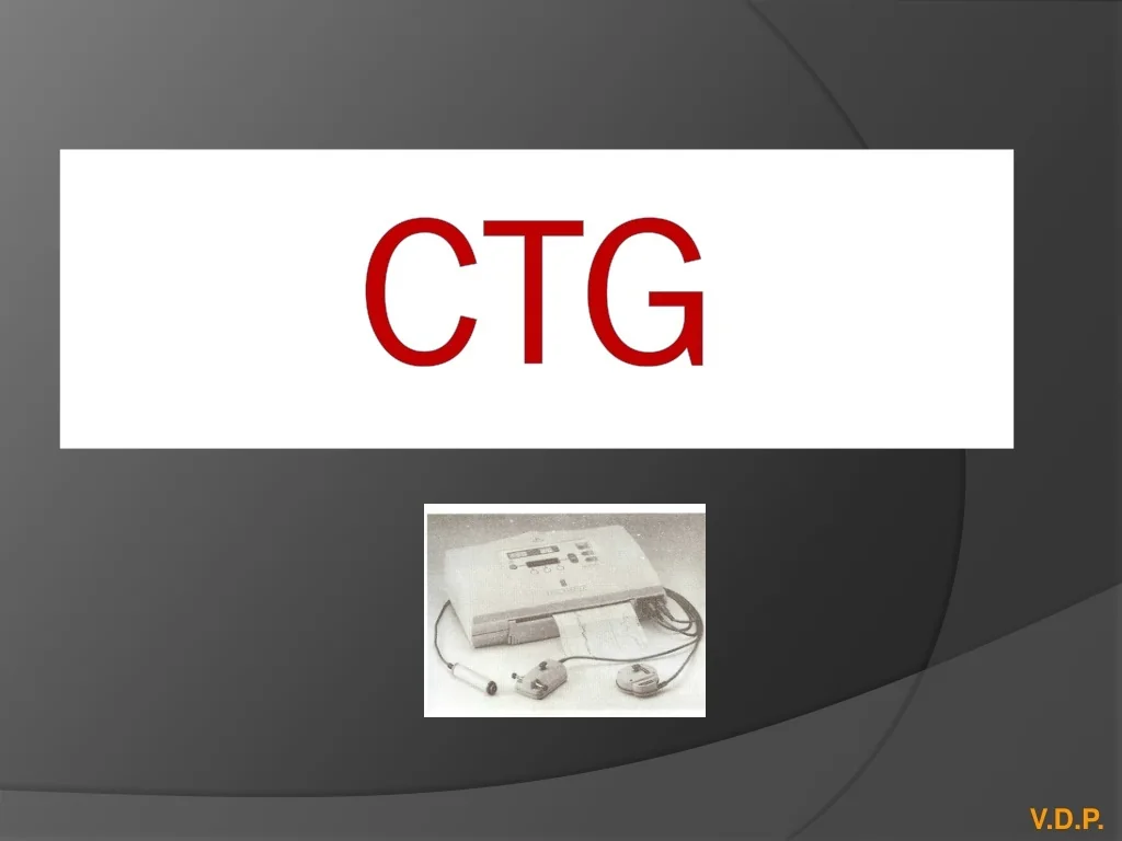 PPT - CTG PowerPoint Presentation, free download - ID:9428356