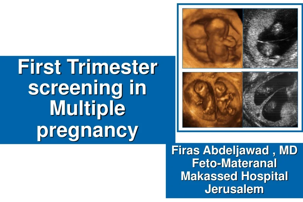 PPT - First Trimester screening in Multiple pregnancy PowerPoint ...