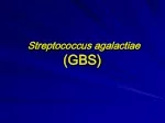 PPT - Streptococcus agalactiae PowerPoint Presentation, free download ...