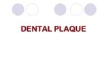 PPT - Dental Plaque PowerPoint Presentation, free download - ID:7945755