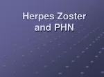 PPT - Herpes Zoster and Post-Herpetic Neuralgia PowerPoint Presentation ...