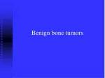 PPT - Bone Tumors PowerPoint Presentation, free download - ID:596260