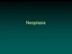PPT - Pathology Lecture - Neoplasia PowerPoint Presentation, free ...