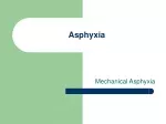 PPT - Birth asphyxia PowerPoint Presentation, free download - ID:1220440