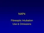 PPT - Supraglottic Airway Devices Nap4 PowerPoint Presentation, free ...