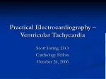 PPT - Ventricular Tachycardia PowerPoint Presentation, free download ...