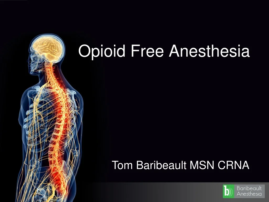PPT - Opioid Free Anesthesia PowerPoint Presentation, free download ...