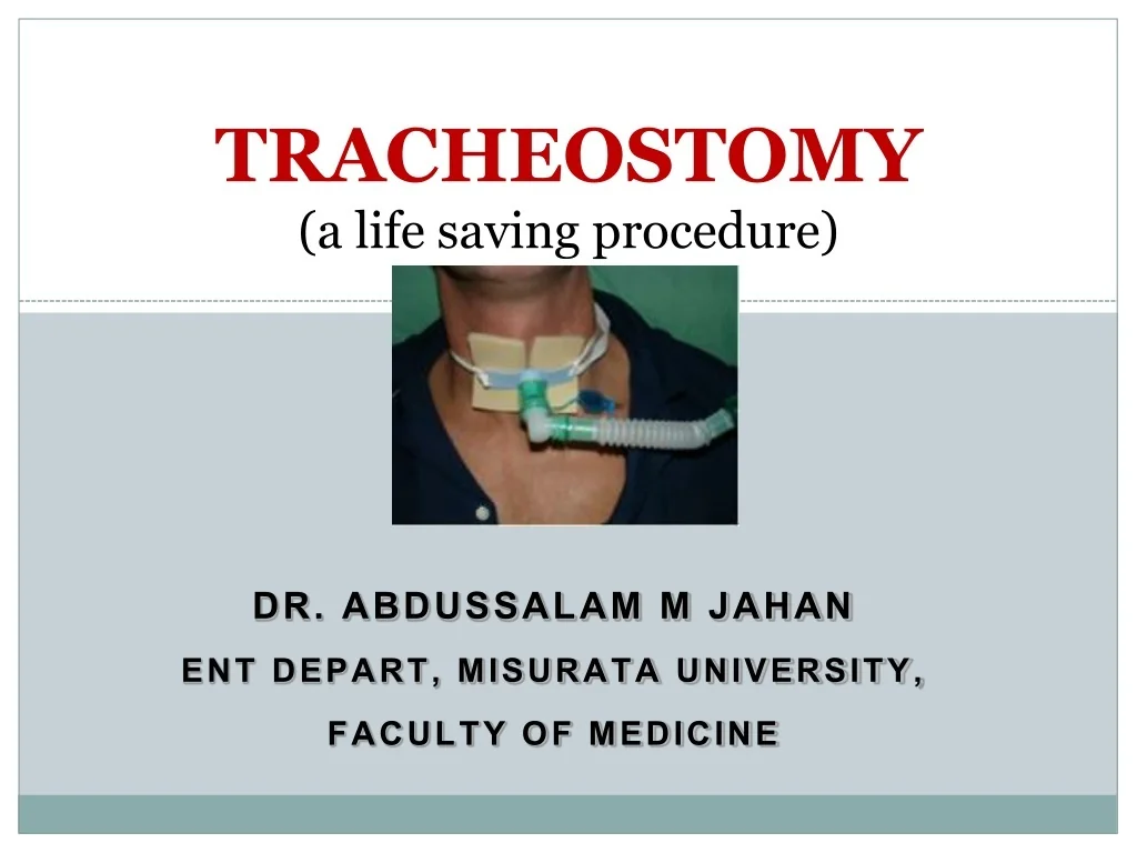 PPT - Tracheostomy: Life-Saving Procedure PowerPoint Presentation, free ...