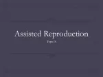 PPT - ASSISTED REPRODUCTION TECHNICS PowerPoint Presentation, free ...