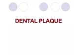 PPT - Dental Plaque PowerPoint Presentation, free download - ID:7945755
