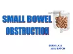PPT - Small Bowel Bacterial Overgrowth PowerPoint Presentation, free ...