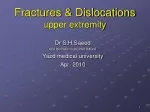PPT - Fractures and dislocations PowerPoint Presentation, free download ...