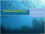 PPT - Dermatophytosis PowerPoint Presentation, free download - ID:1975673