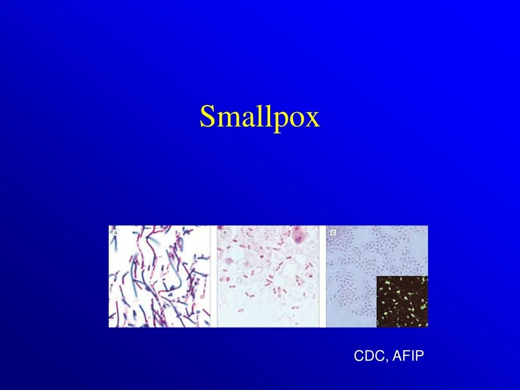 PPT - Smallpox: Transmission, Symptoms, and Management PowerPoint ...