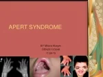 PPT - Apert Syndrome PowerPoint Presentation, free download - ID:512041