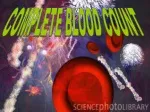 PPT - Complete Blood Count Test PowerPoint Presentation, free download ...